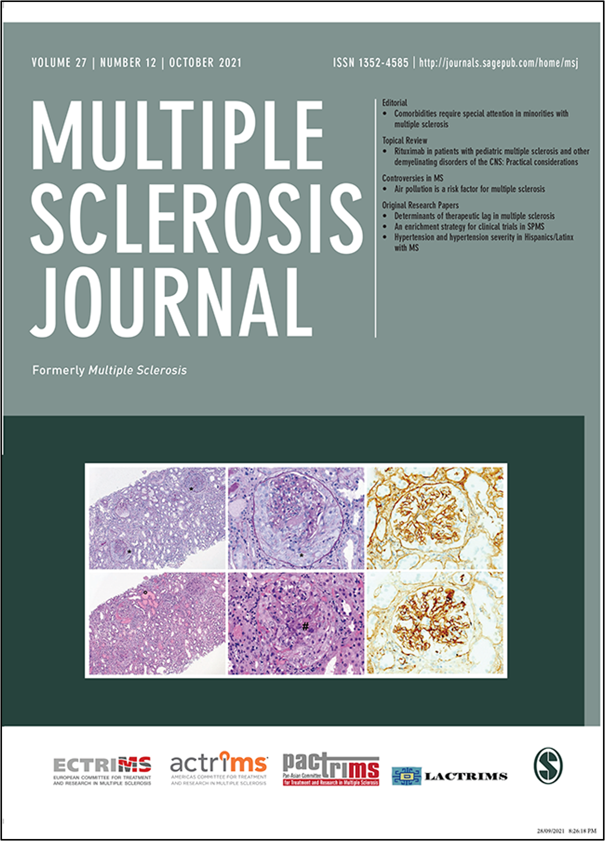Call for Editor-in-Chief for Multiple Sclerosis Journal: Multiple Sclerosis Journal: Sage Journals